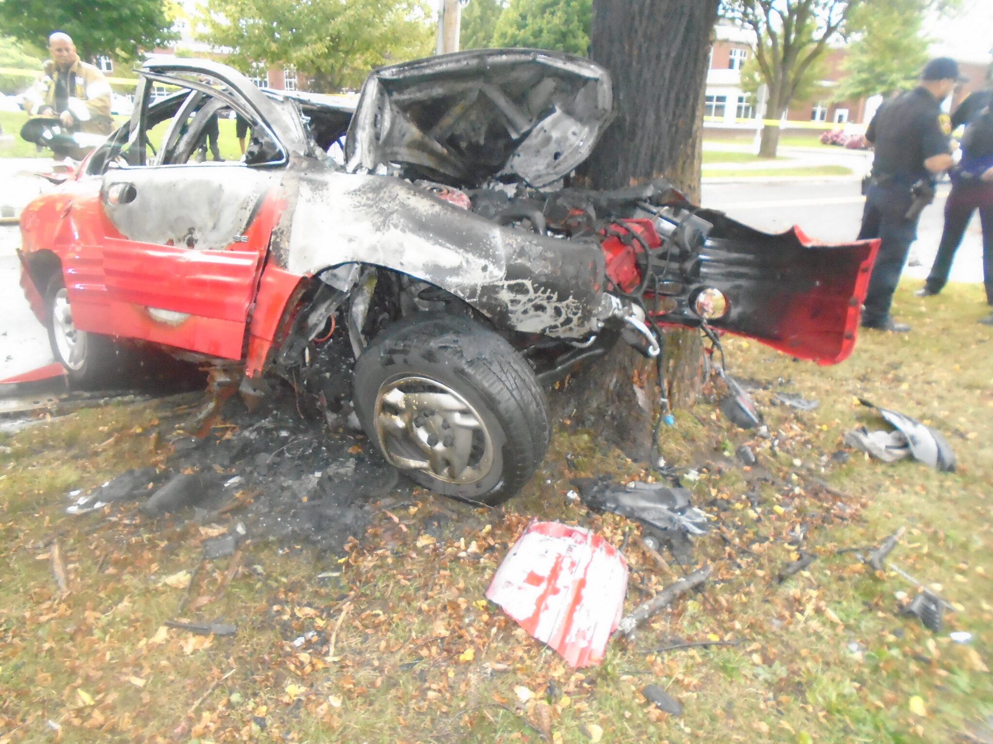 Ways to treat Burn Injuries sustained from Car Accidents